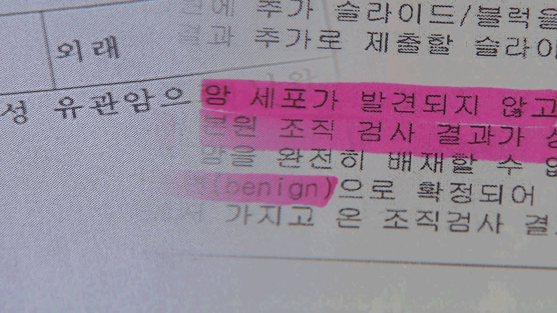 ‘유방암 확진’에 수술까지 했는데…뒤바뀐 검체로 오진 | TVING