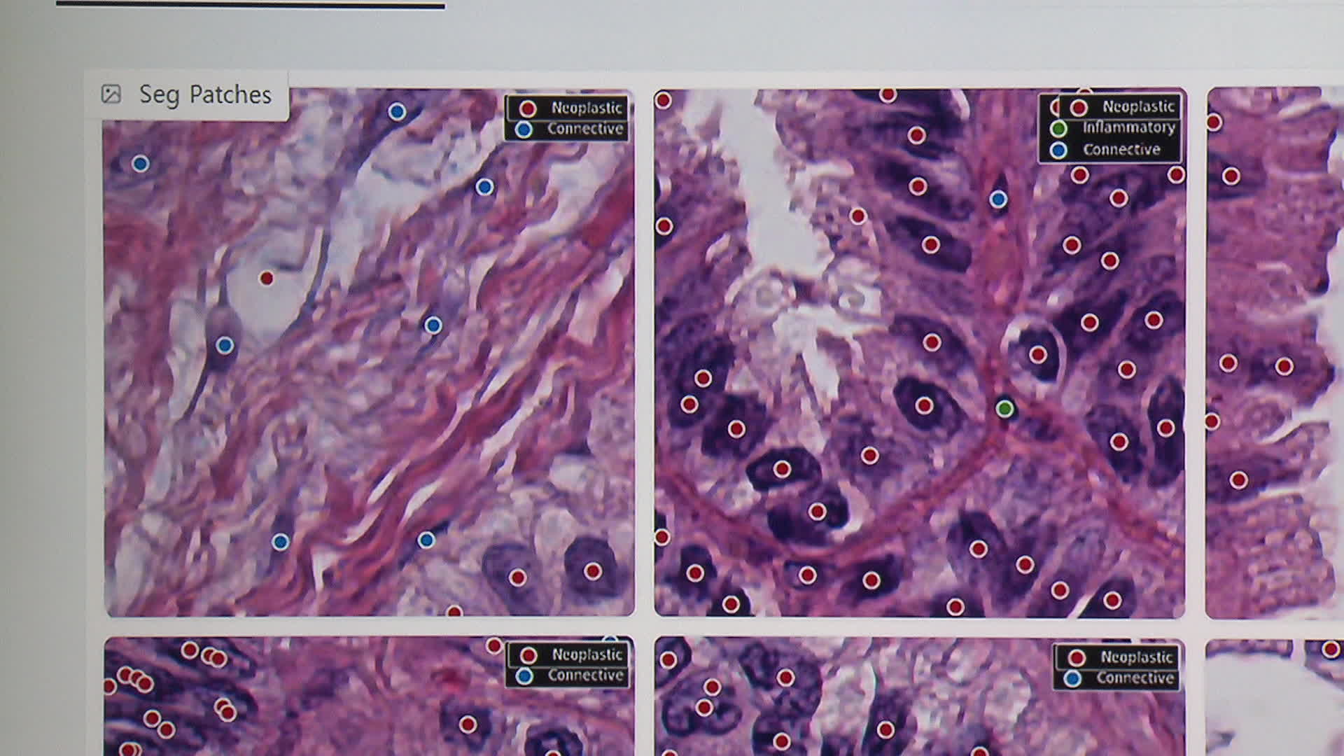 암 진단도 내리는 특화된 AI까지…“‘맞춤형 독자 AI’가 적합” | TVING